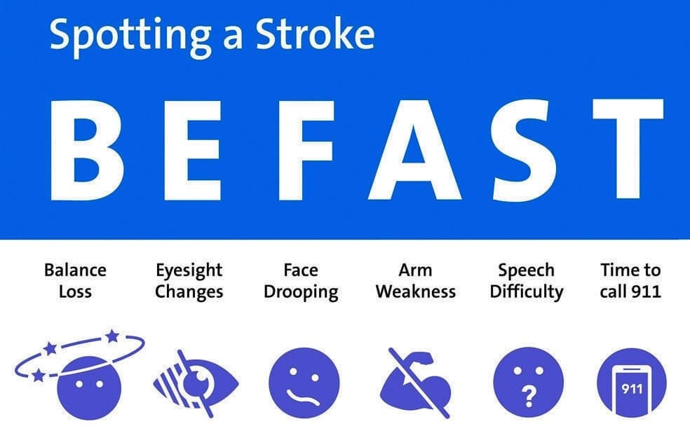 Timely stroke care essential for recovery, UMMC experts say – Jackson ...